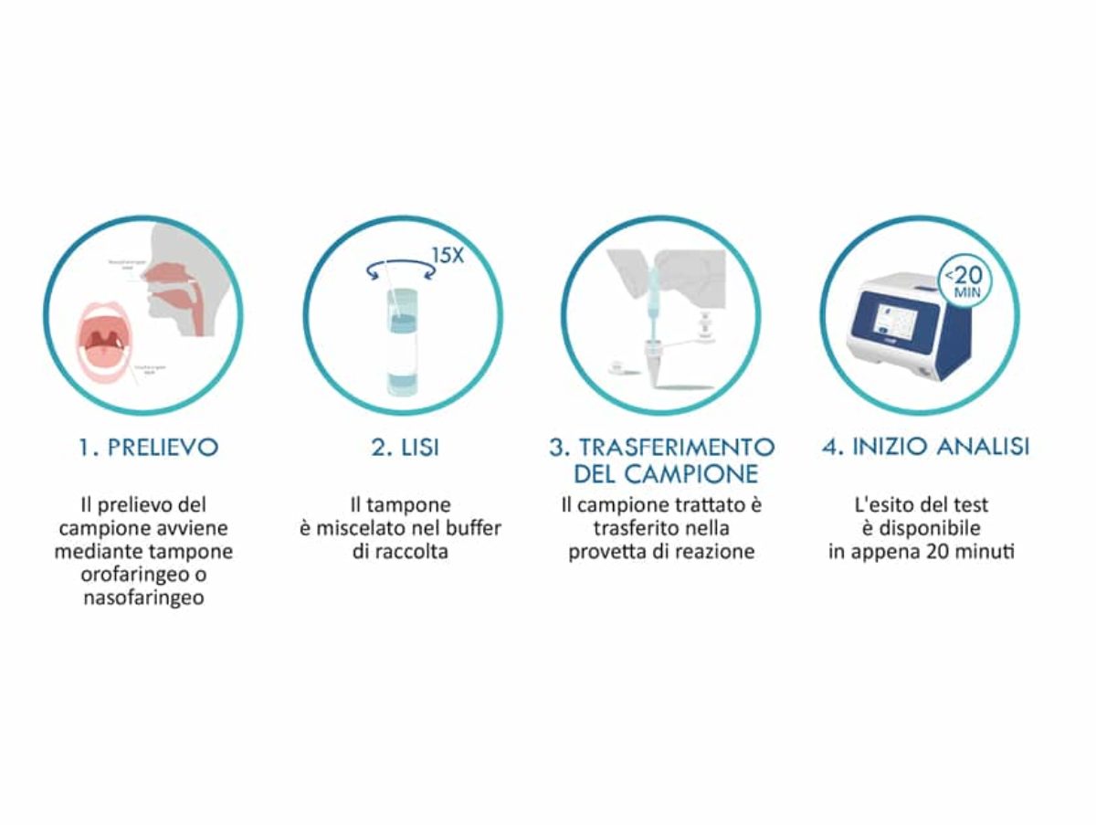 Covid-19 o influenza? Il test molecolare di Menarini Diagnostics