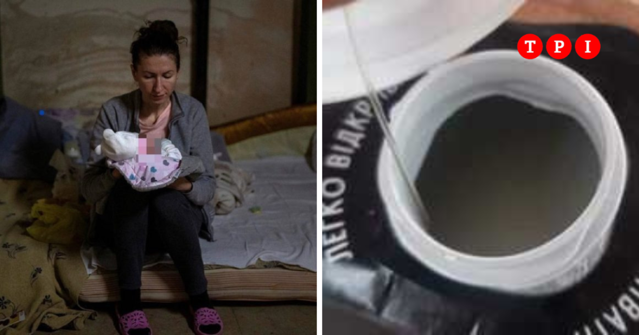 Le fotografie che mostrano le differenze dei gemelli omozigoti