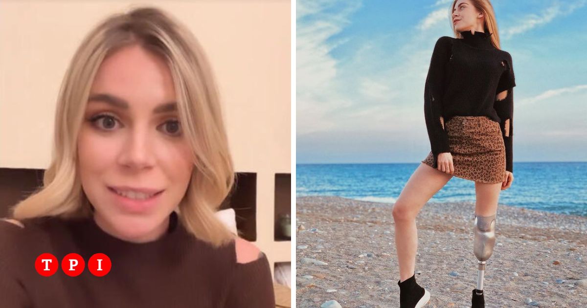 Nina Rima, l'influencer con la protesi, contro Gardaland: "Discriminata"