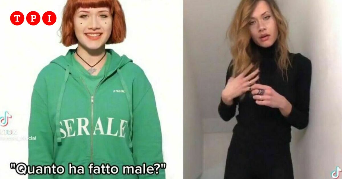 Tish, la cantante di Amici trasformata sui social: "Quanto ha fatto male?"