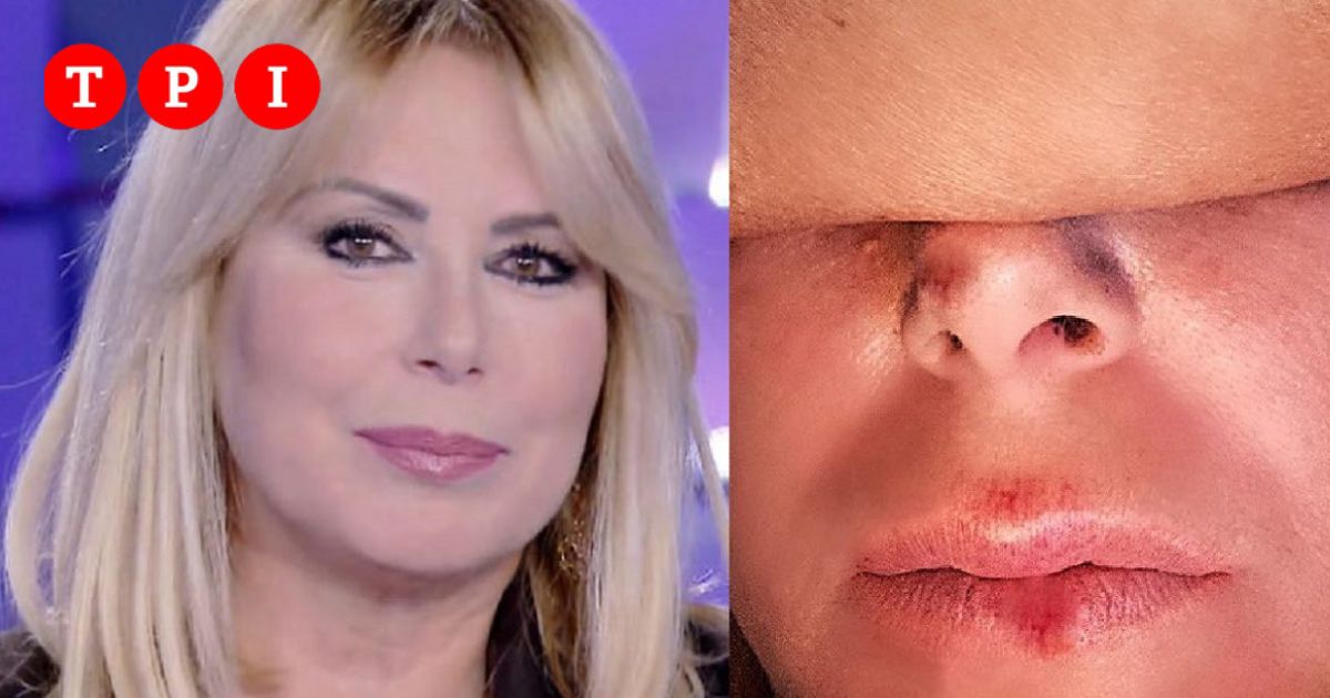 Monica Leofreddi investita mentre aspettava taxi. L'accusa: "Ti sei ...