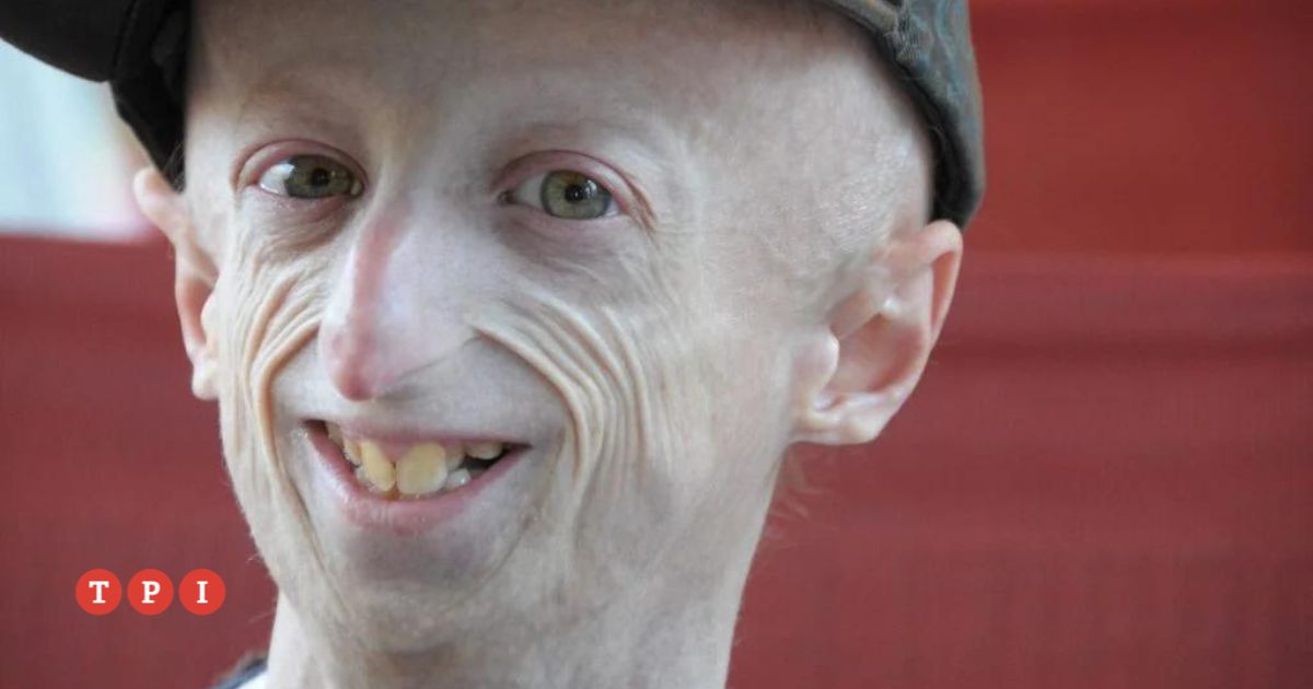 Sammy Basso è morto tra le braccia della madre: "Mi manca il respiro"